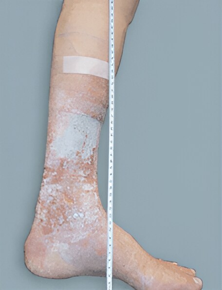 Before & After - StrideCare