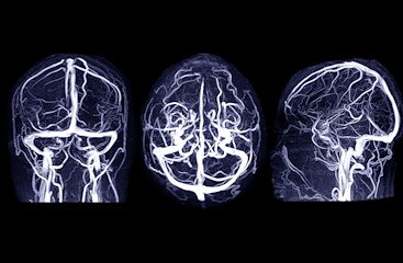 Diagnostic Venous Ultrasound