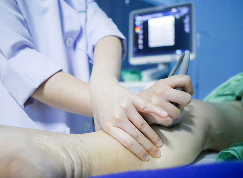 Vein Disease Tests: Diagnostic Venous Ultrasound or Venography - StrideCare