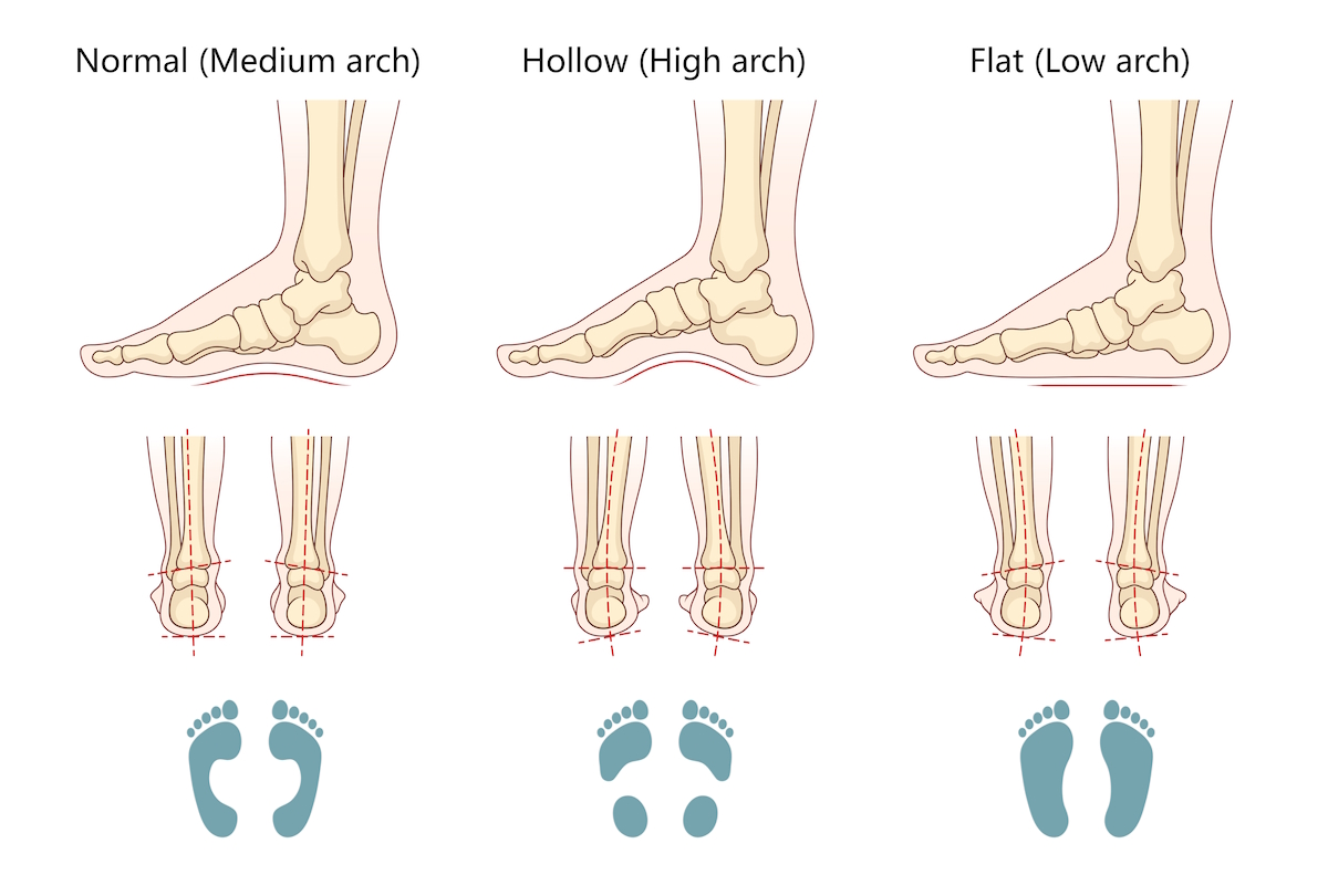 10 Signs You Need a Foot Doctor (Not Just a Primary Doctor)
