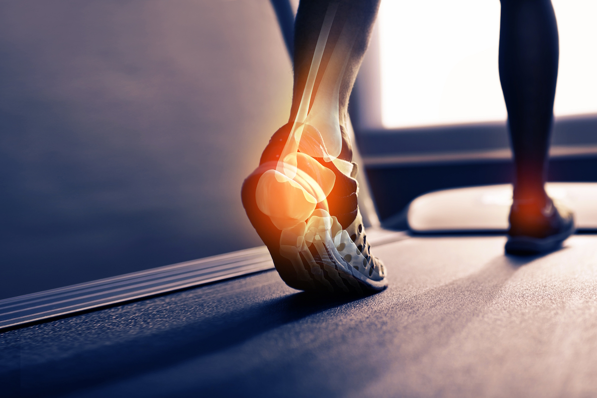 How Orthotics and Orthotic Insoles Can Transform Foot Health - StrideCare