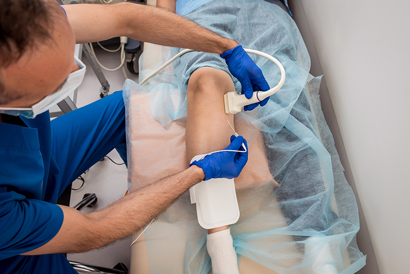 17 FAQs Patients Ask About Radiofrequency Ablation (RFA) - StrideCare