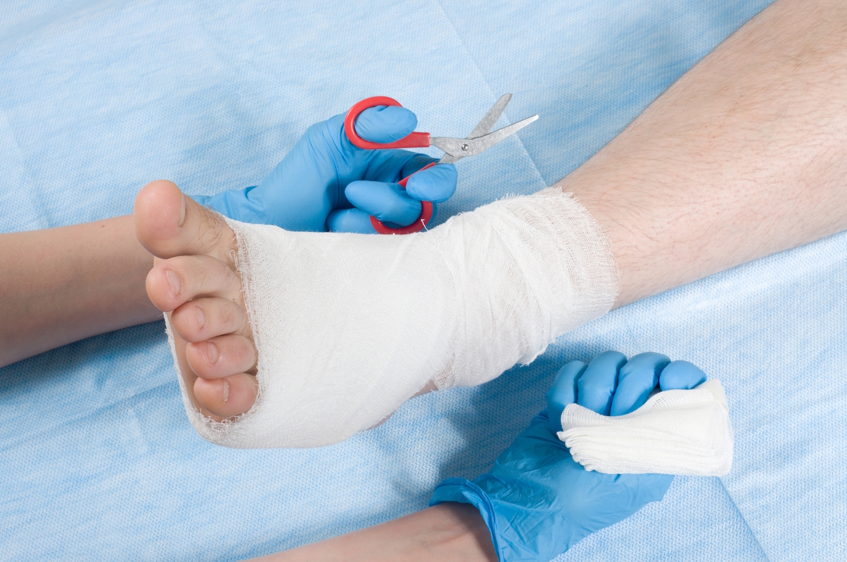 7 Common Wound Care Mistakes and How To Avoid Them