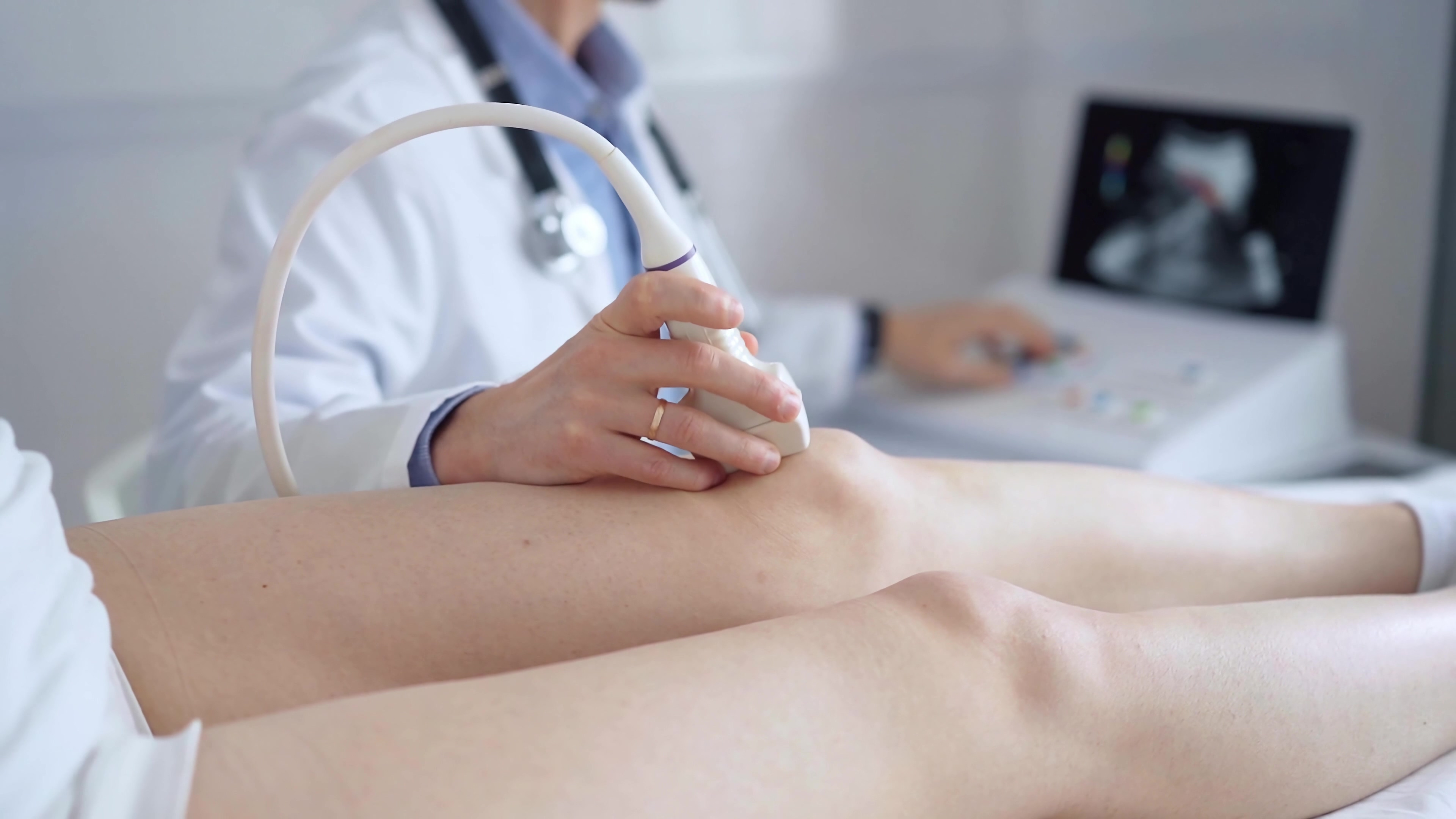 Diagnostic Venous Ultrasound